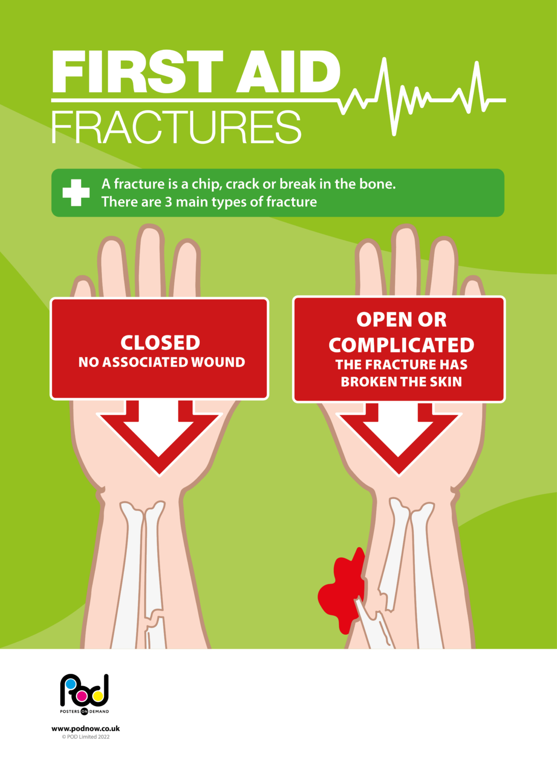 First Aid - Fractures | POD | Posters On Demand