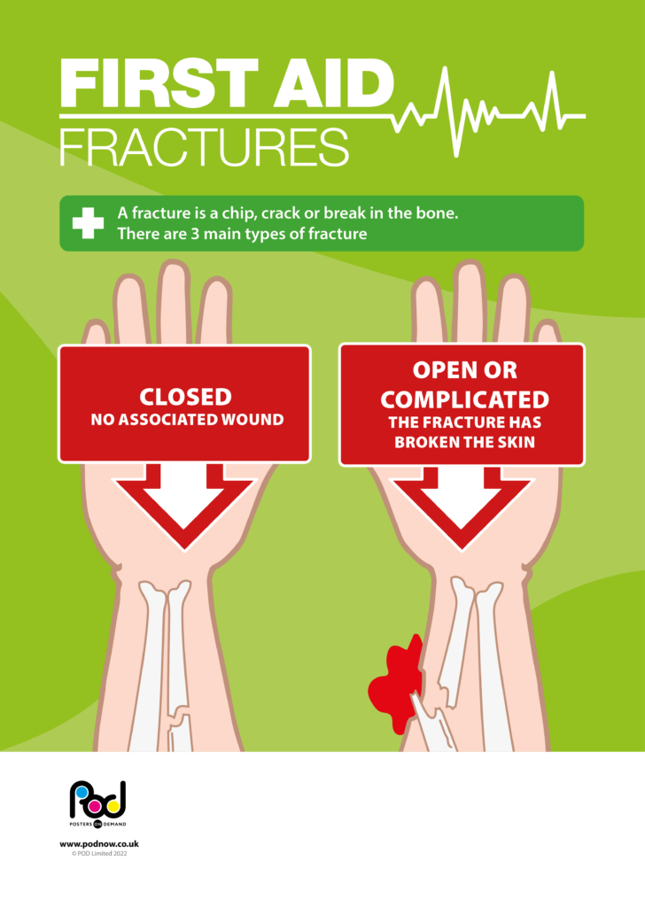First Aid - Fractures | POD | Posters On Demand